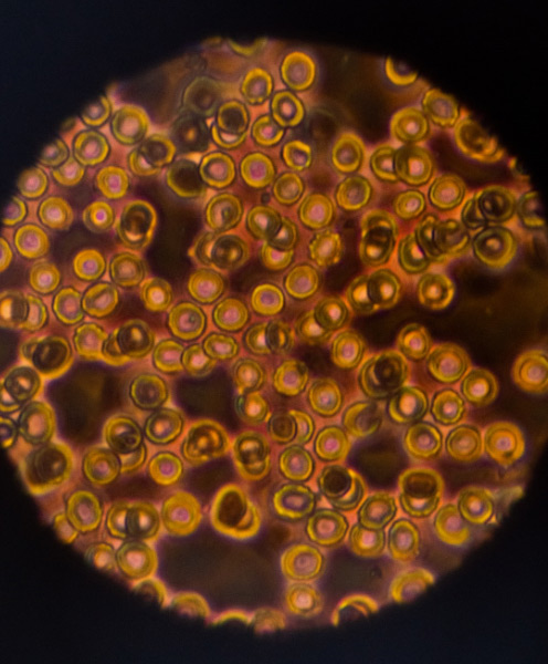 Fermentation story | Microbiome Center